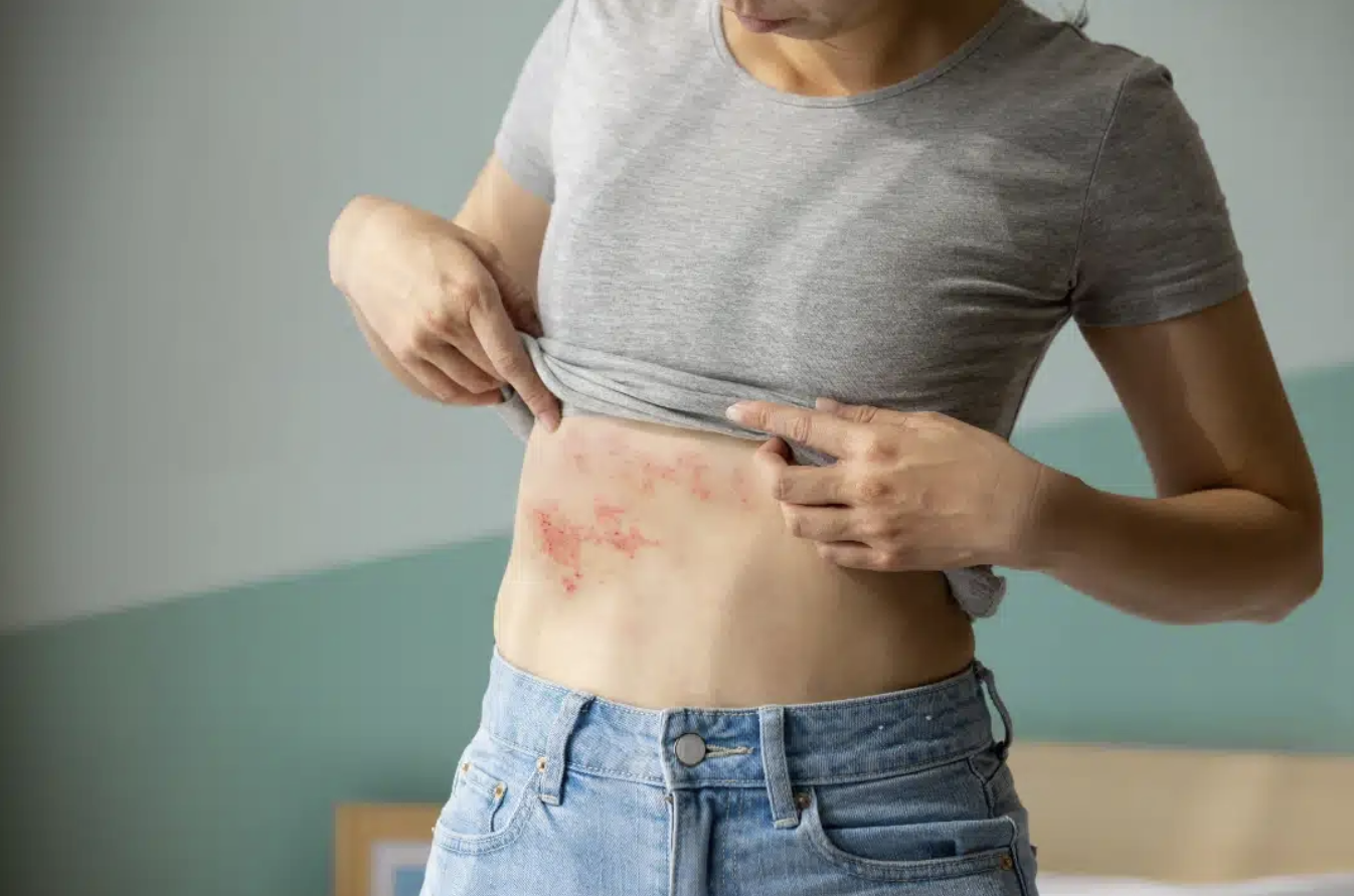 Understanding the Different Types of Herpes: HSV-1, HSV-2, and Beyond ...